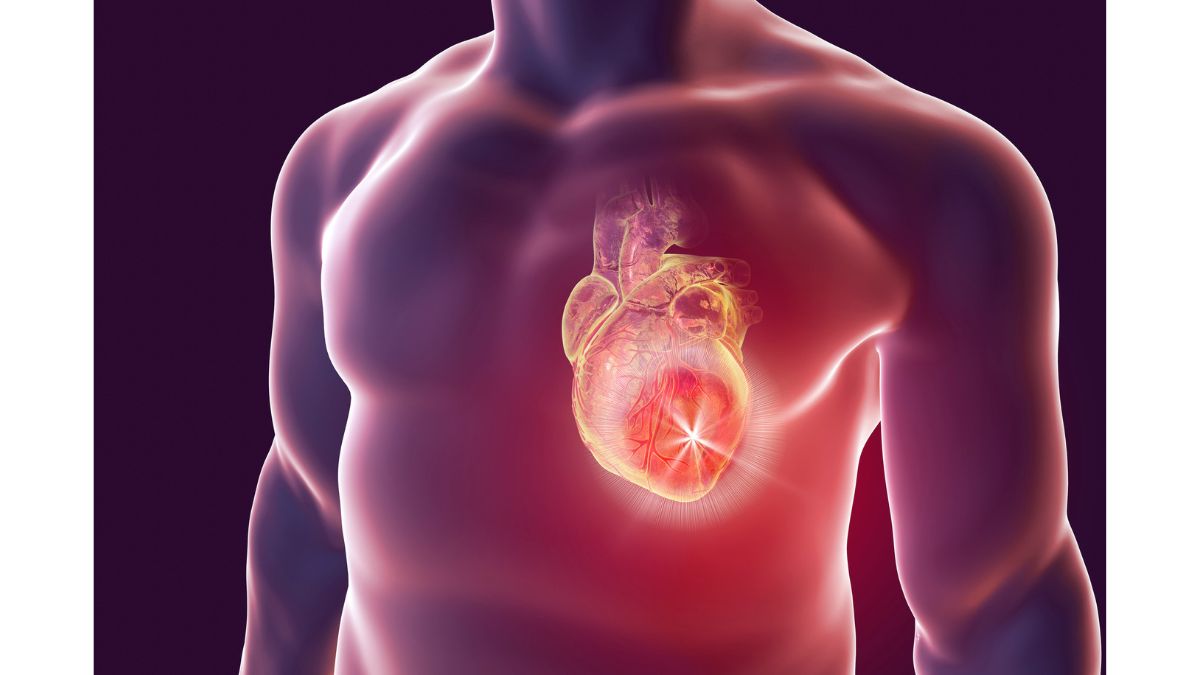 Heart Attack And Cardiac Arrest: Understanding The Differences From An Expert